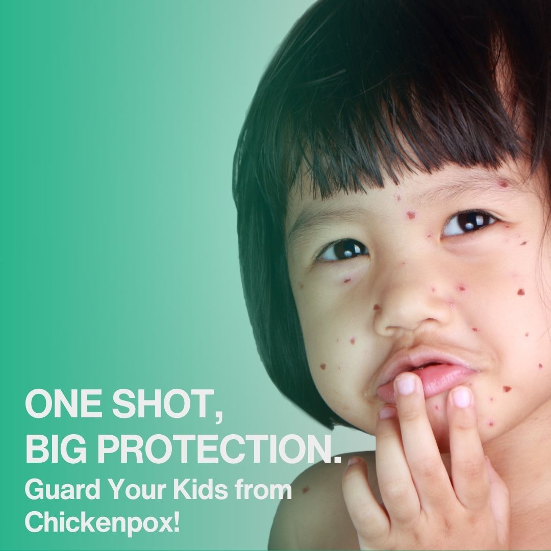 Children's Chickenpox Vaccination - SBCC Baby & Child Clinic